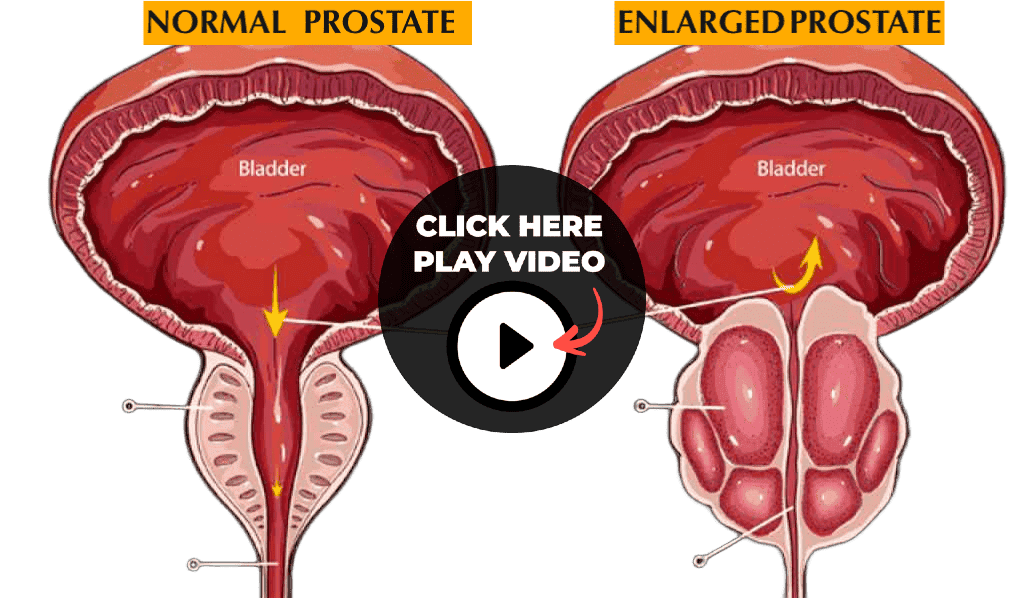 Beyond PSA Tests: Here’s What Men 60+ Are Doing Differently